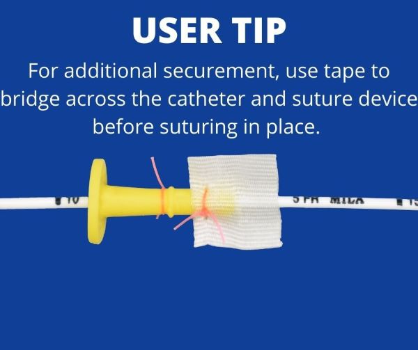 Mila Tomcat urinary catheter, 3,5Fr. w/stylet adj. length 25 • Jan F ...